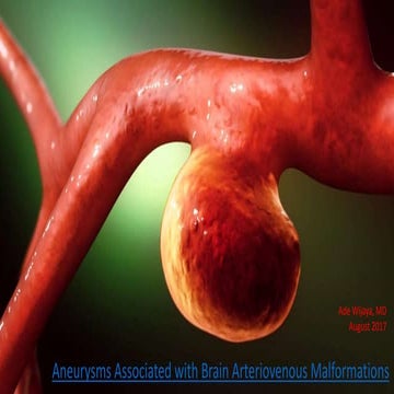 Brain AVM related aneurysms | PPTX