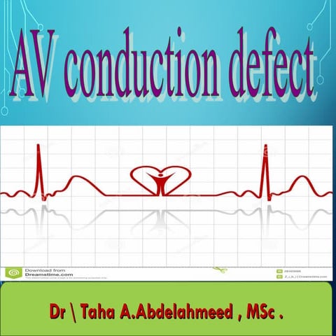 lecture on AV conduction defect of heart | PPT