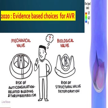 2020: Evidence based choices for AVR | PPT