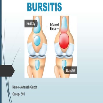 Topic- Bursitis .pptx