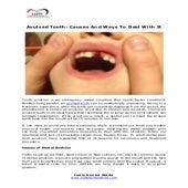 Avulsed Tooth: Causes And Ways To Deal With It