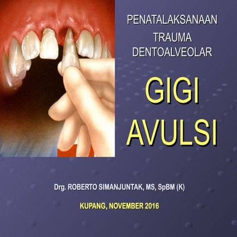 avulsi gigi: penyebab dan prosedur tata laksana | PPT