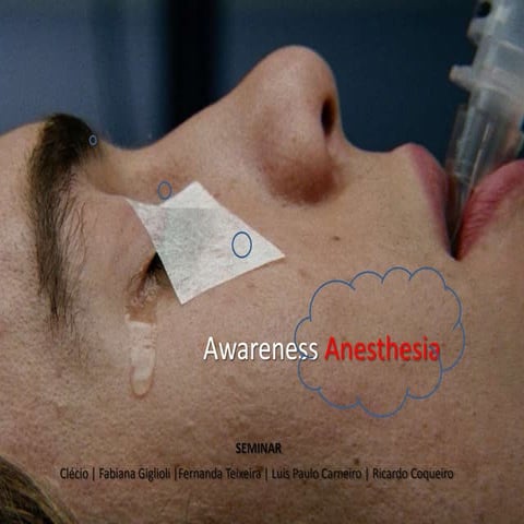 Awareness Anesthesia | PPTX