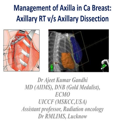 Axillary radiotherapy versus axillary surgery in breast cancer | PPTX
