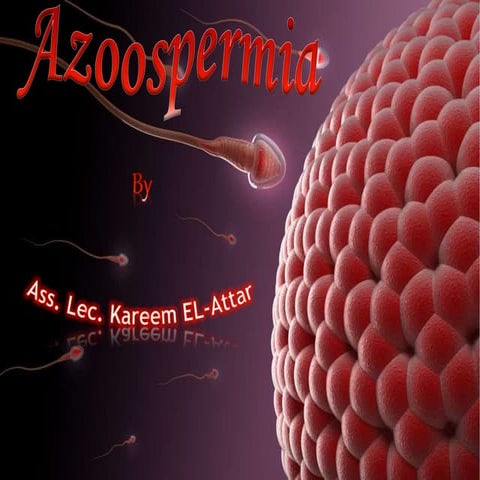 Azoospermia how to manage azoospermia.pptx