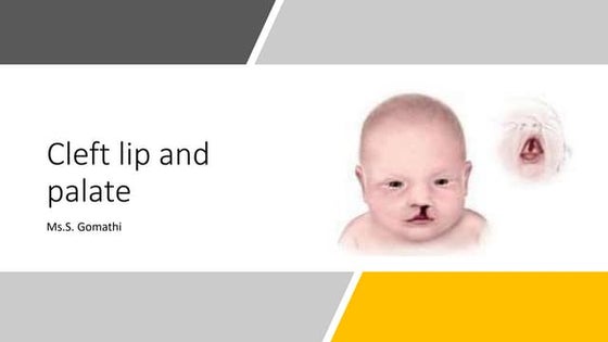cleft lip and palate | PPTX | Ear, Nose and Throat Conditions | Diseases and Conditions