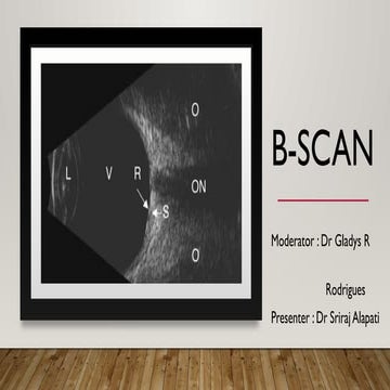 B-Scan procedure basics in ophthalmology.pptx