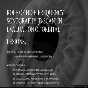 B-scan paper for occular diseases diagnosis.pptx