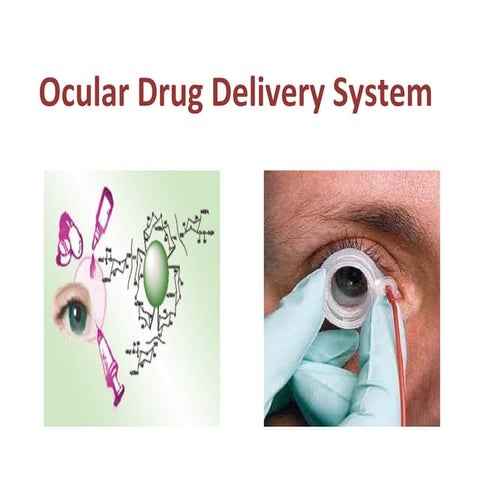 ocular drug delivery systems | PPTX