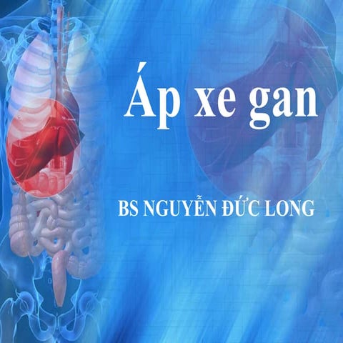 B23 apxe gan | PPT
