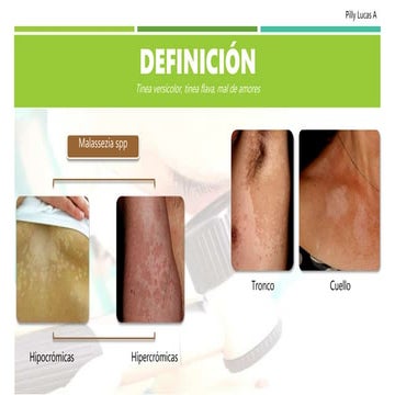 Pitiriasis Versicolor Dermatología Pptx