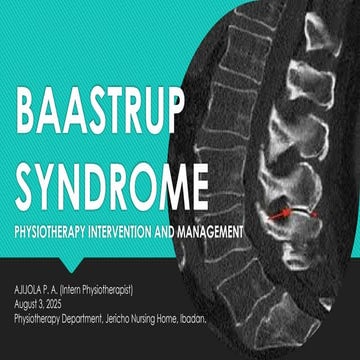 Baastrup Syndrome: Physiotherapy Management | PPTX