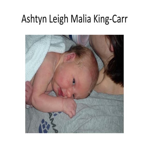 Baby Ashtyn | PPTX