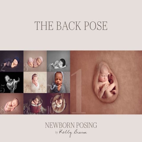 Baby poses new bone | PDF