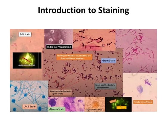Gram positive and gram negative bacteria | PPTX