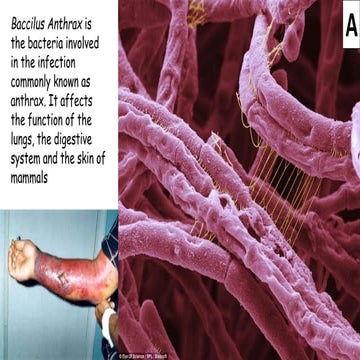 Bacteria Disease Examples | PPTX | Infectious Diseases | Diseases and ...