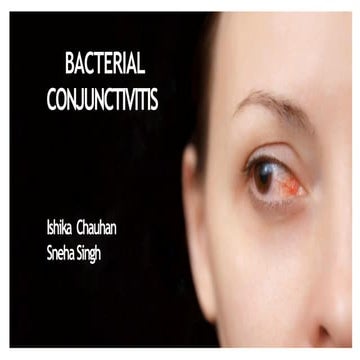 conjunctivitis bacterial viral ppt.pptx