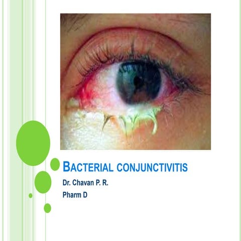 Bacterial conjunctivitis Pharmacotherapy | PPTX