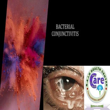 Bacterial conjunctivitis | PPT