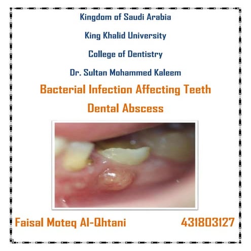 Bacterial infection affecting teeth Dental Abscess | DOCX