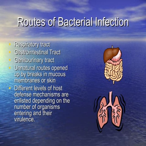 Bacterial infections | PPT