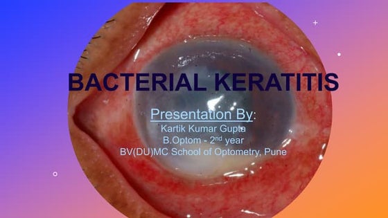 Bacterial corneal ulcer (pathogenesis, pathology, clinical features). | PPT
