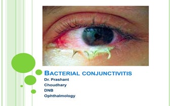 Bacterial Conjunctivitis