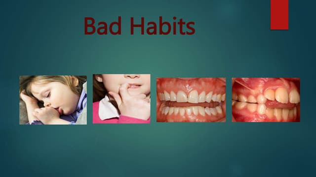Habit breaking appliances | PPTX