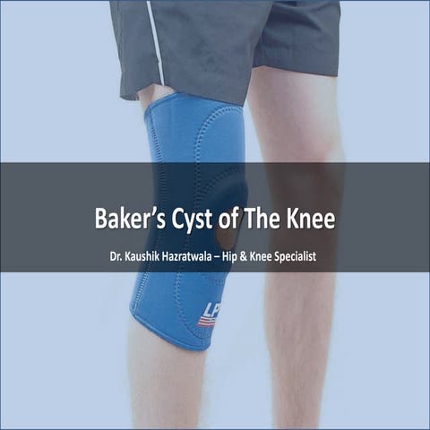 Knee Brace For Bakers Cyst