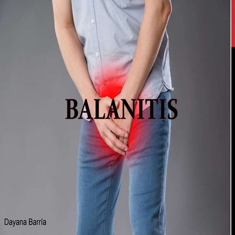 Balanitis.pptx