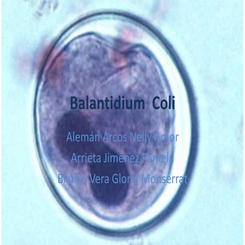 Balantidium coli | PPTX