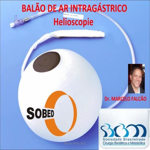 Balao intragastrico de ar. falcao | PPT