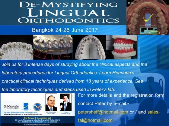 De-mystifying Lingual Orthodontics 1 | PPT