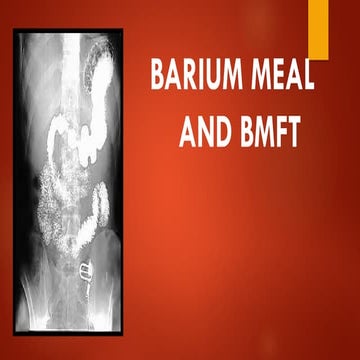 Barium meal and BMIT radiology studentss | PPTX