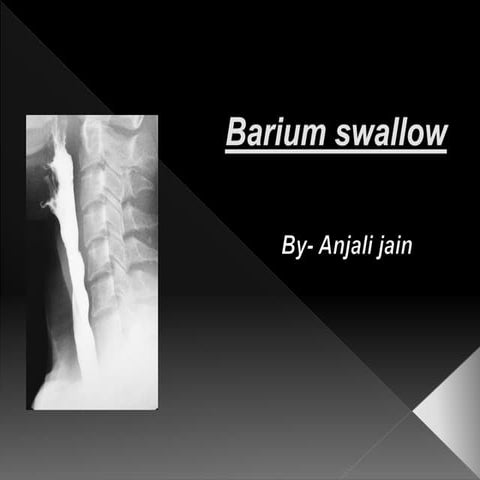 Barium swallow | PPTX