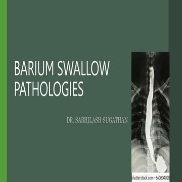 Esophageal Candidiasis Barium Swallow