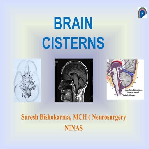Cisterns of brain | PPTX