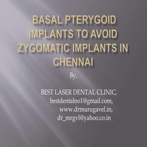 Basal Pterygoid Implants To Avoid Zygomatic Implants Ppt