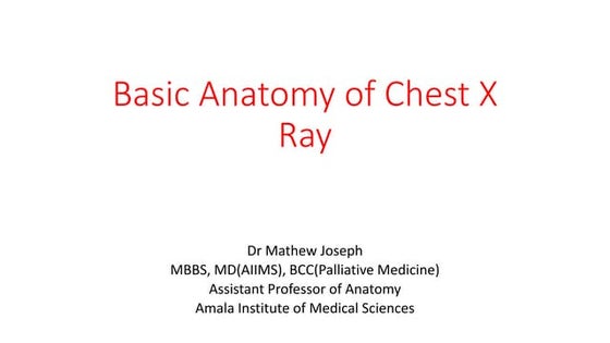 normal Chest x-ray radiological landmarks.ppt