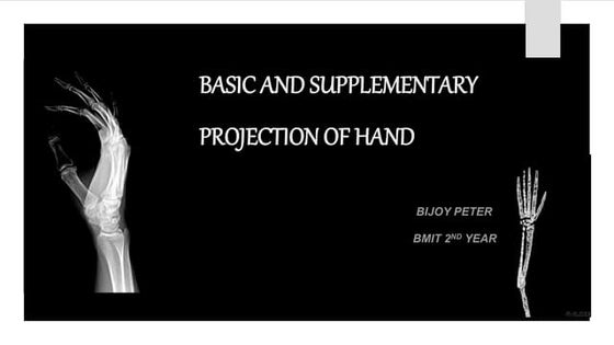 ROUTINE PROJECTIONS FOR HAND............ | PPTX