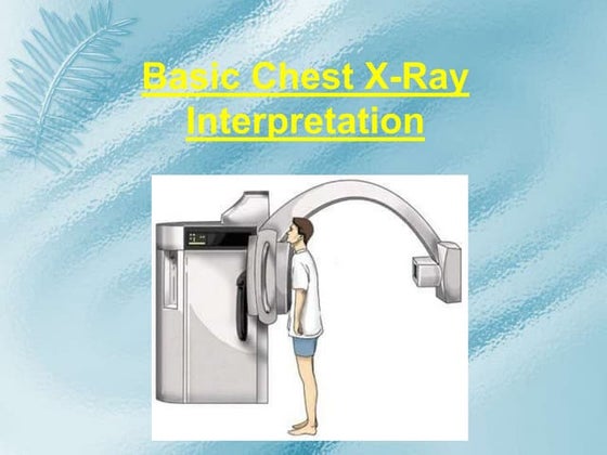 normalxray.ppt