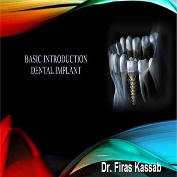 Basic dental implant | PPT