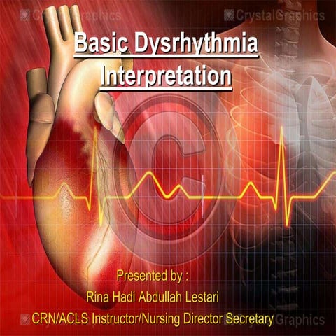 Basic dysrhythmia interpretation | PPTX