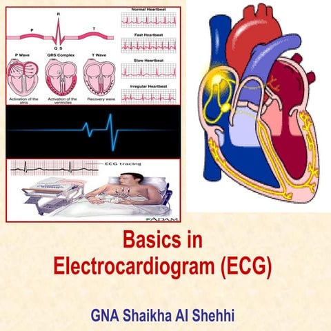 lecture on basic ecg for doctors and nurses | PPT