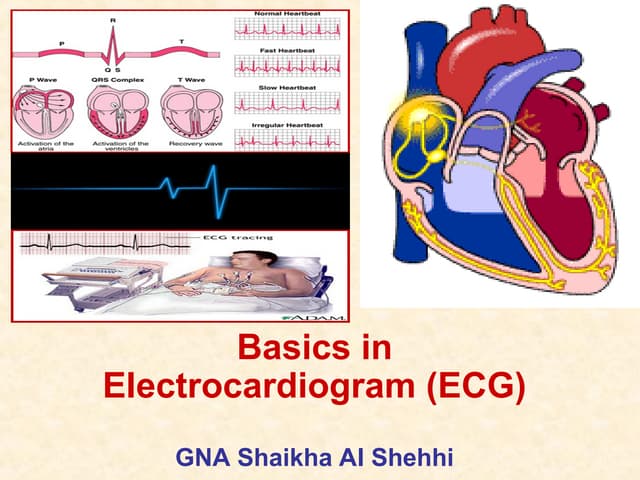 Procedure of Recording ECG | PDF