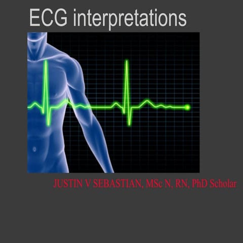 Basic ecg interpretations | PDF | Heart and Cardiovascular Diseases ...