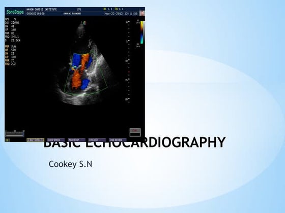 LEFT VENTRICULOGRAPHY.pptx