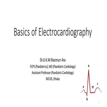 ECG interpretation: the basics | PPT