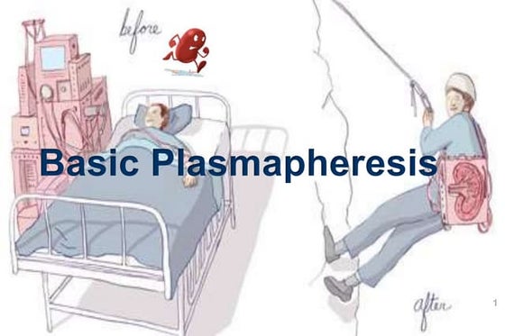 Plasmapheresis | PPT