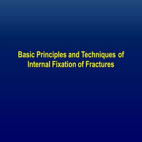 Plating principles in Orthopaedics | PPTX